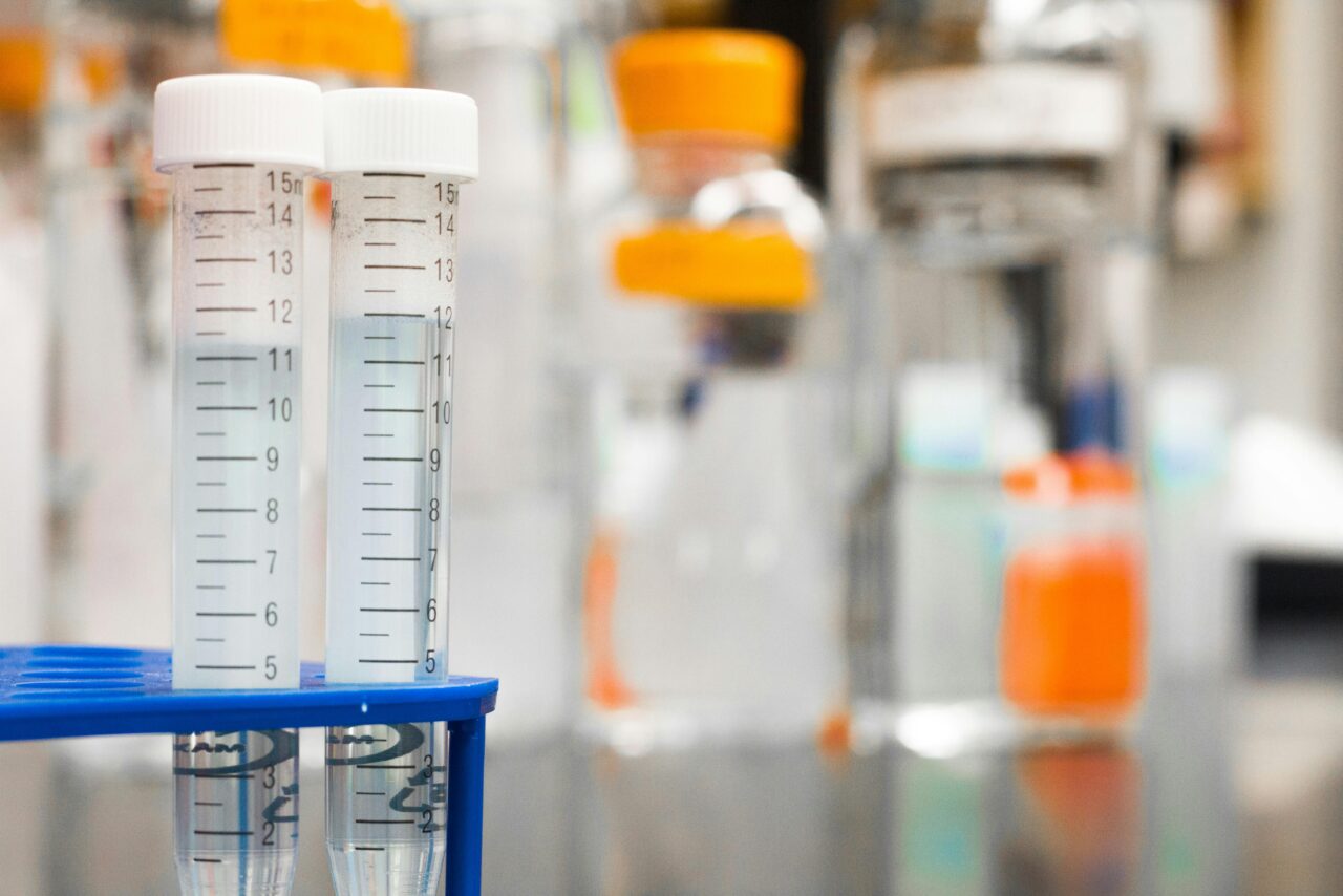 Baseline Labs for Schizophrenia: What PMHNPs Should Order - Stress Free ...